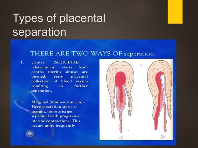 Normal Labor in Obstetrics | PPTX | Pregnancy | Reproductive Health