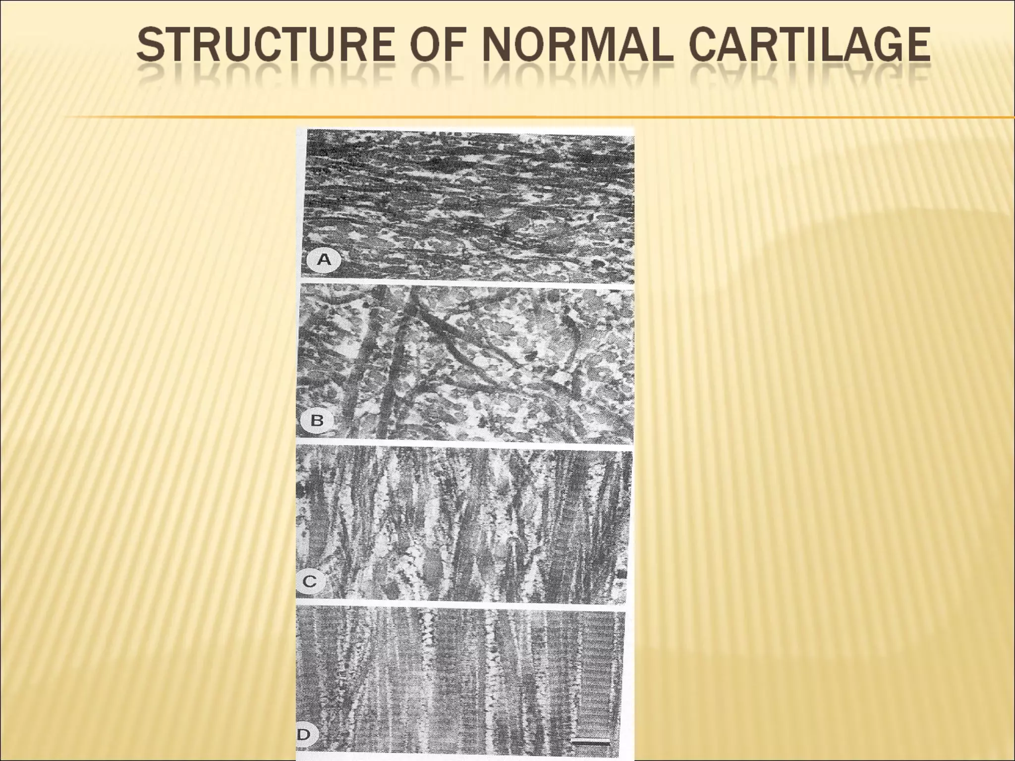 Pathophysiology+of+Osteoarthritis | PPT