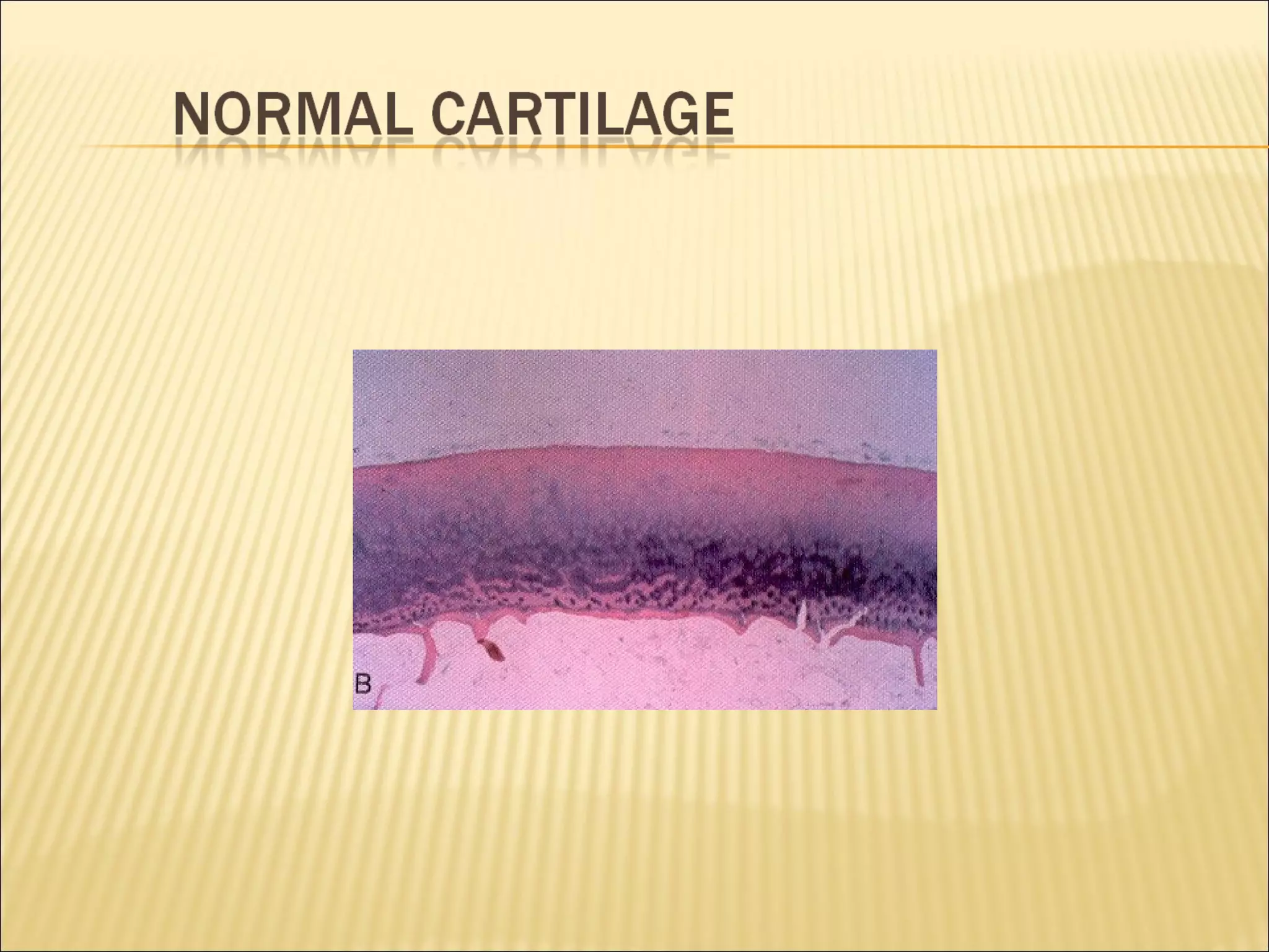 Pathophysiology+of+Osteoarthritis | PPT