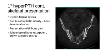 Pathophysiology of parathyroid hormone 2018 | PPT