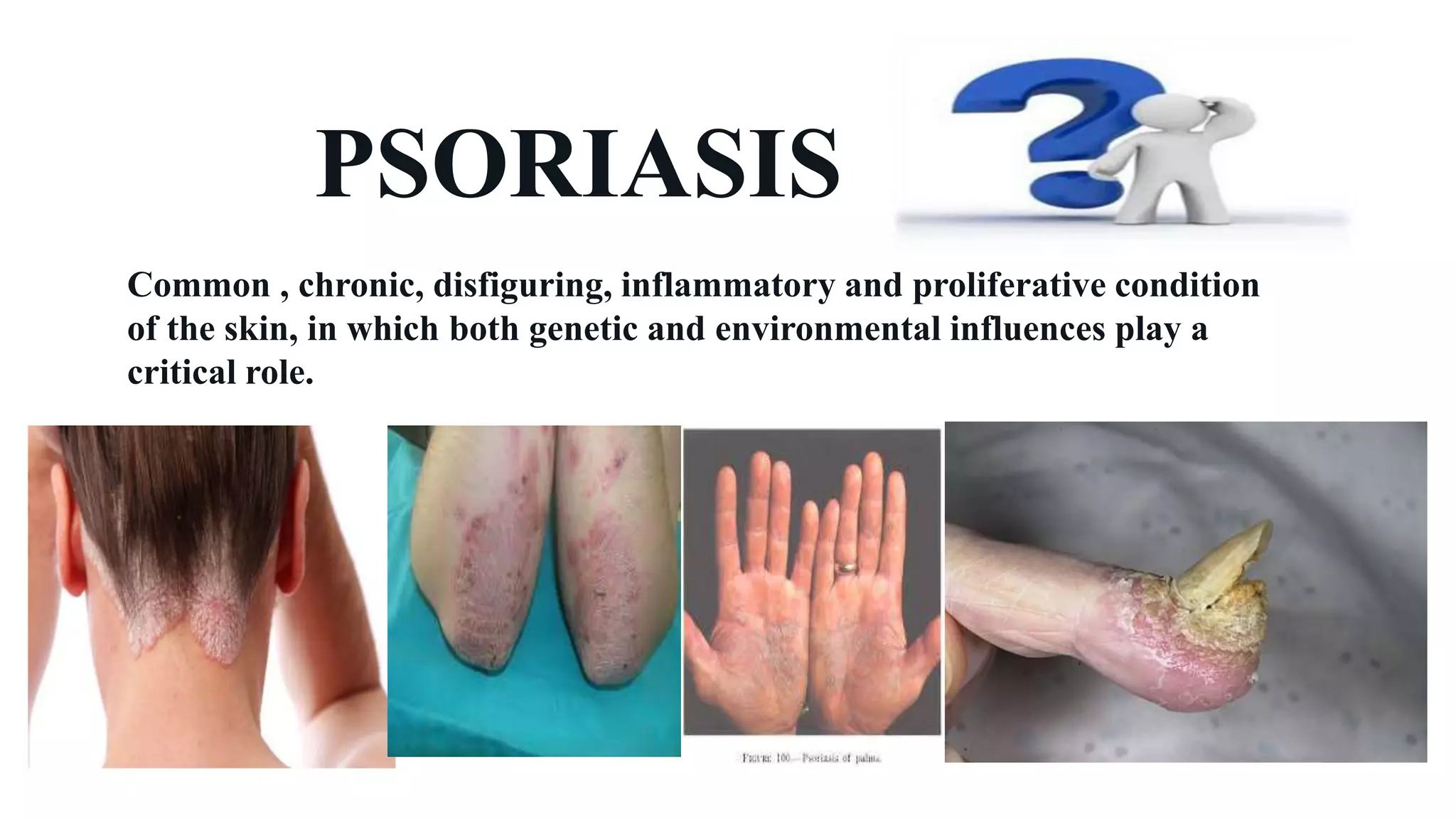 recent advances in the pathophysiology of psoriasis | PPT