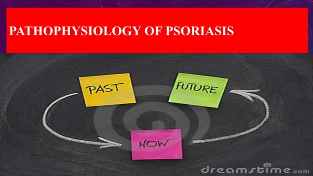 recent advances in the pathophysiology of psoriasis | PPT