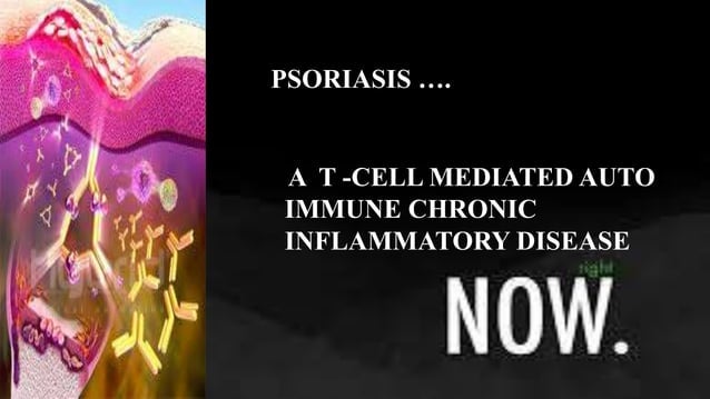 recent advances in the pathophysiology of psoriasis | PPT