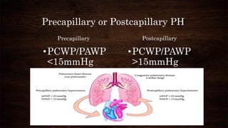 Pathophysiology of pulmonary hypertension | PPTX | Lung and Respiratory ...