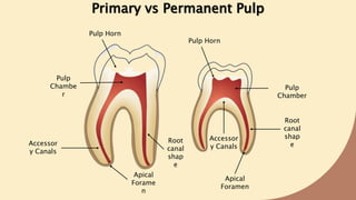 Pathophysiology of pulp | PPTX