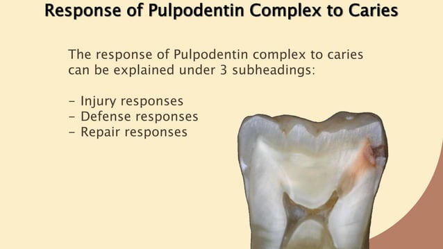 Pathophysiology of pulp | PPTX | Dental Health | Diseases and Conditions