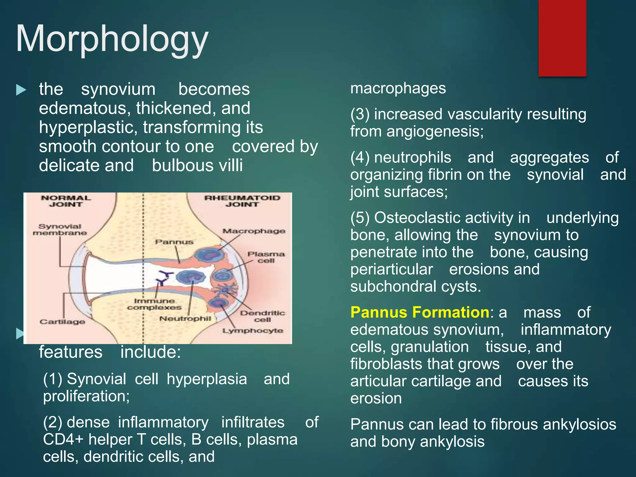 Pathophysiology of Rheumatoid Arthritis | PPTX
