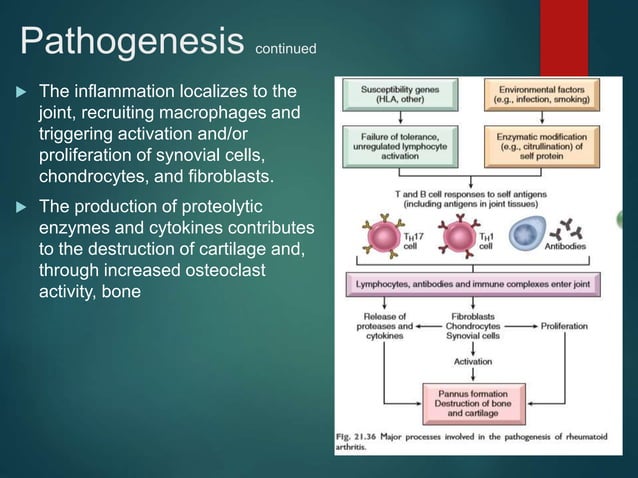 Pathophysiology of Rheumatoid Arthritis | PPTX