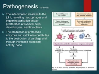 Pathophysiology Of Rheumatoid Arthritis Diagram