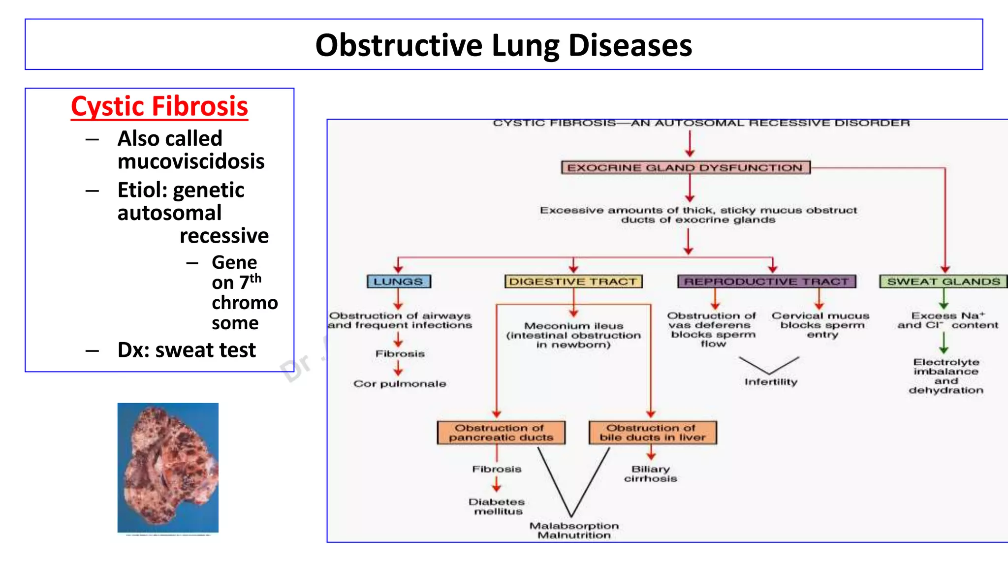 Pathophysiology Of Respiratory Disease | PPT