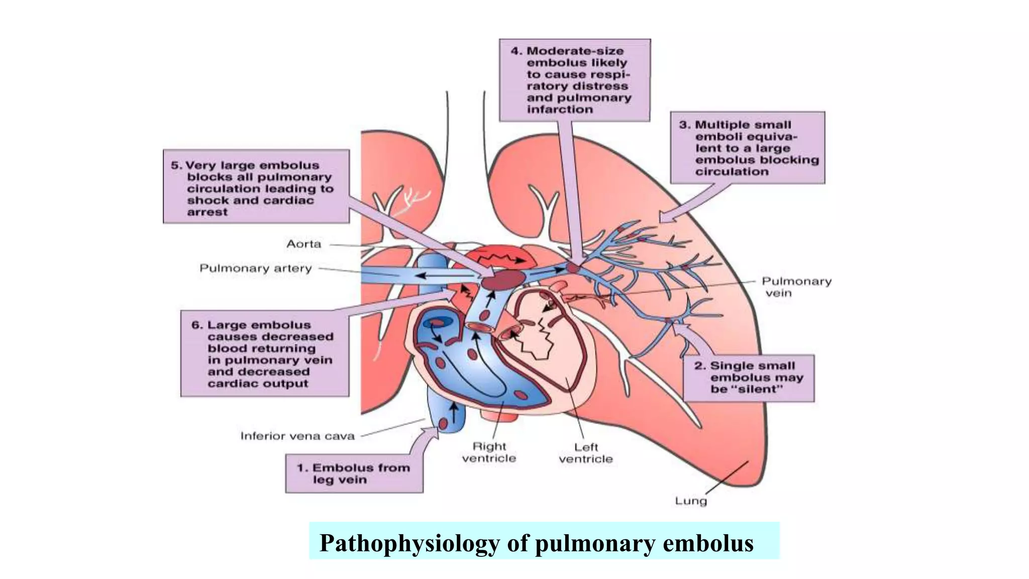 Pathophysiology Of Respiratory Disease | PPT