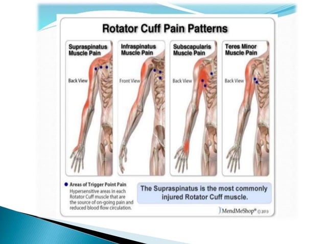Pathophysiology of shoulder rotator cuff instability and repair | PPT
