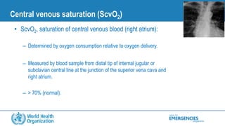 Pathophysiology of sepsis and ARDS.pptx