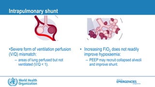Pathophysiology of sepsis and ARDS.pptx