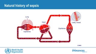 Pathophysiology of sepsis and ARDS.pptx