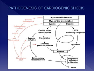 Pathophysiology of shock | PPT