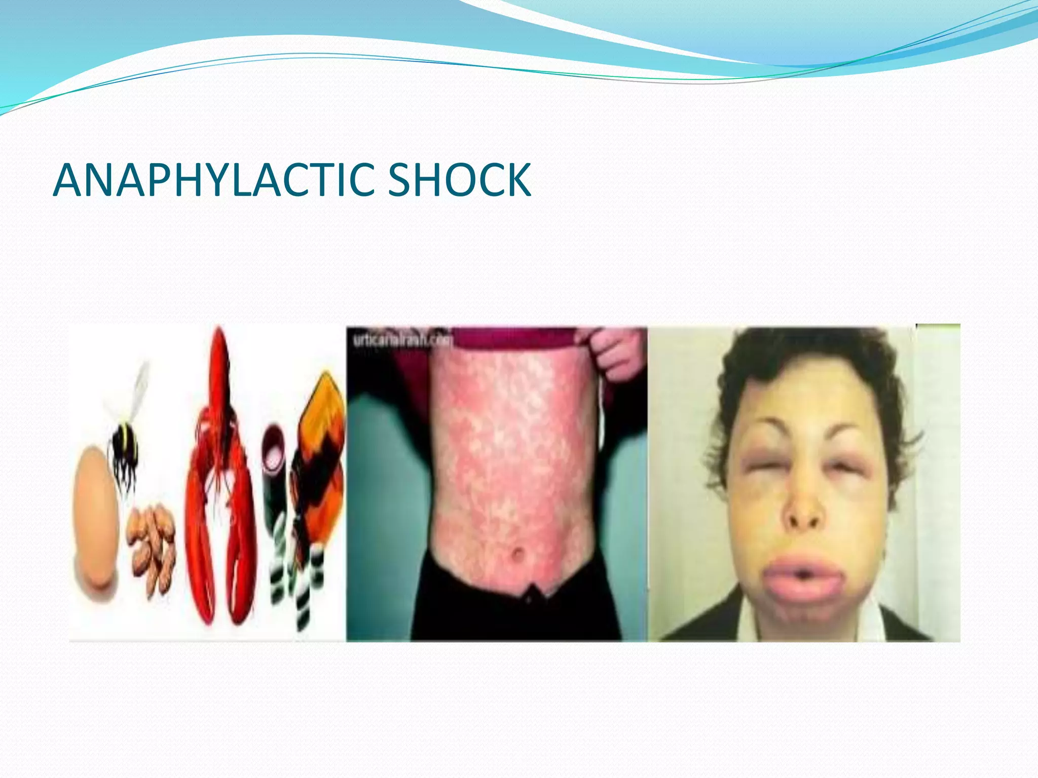 Pathophysiology of shock | PPTX