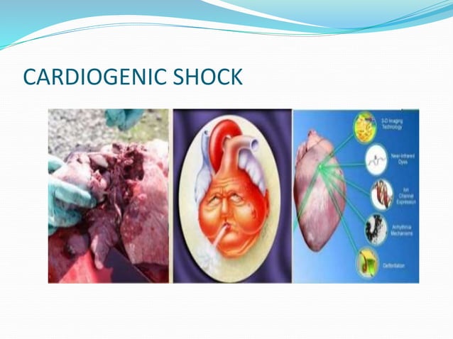 Pathophysiology of shock | PPTX | Lung and Respiratory Health ...