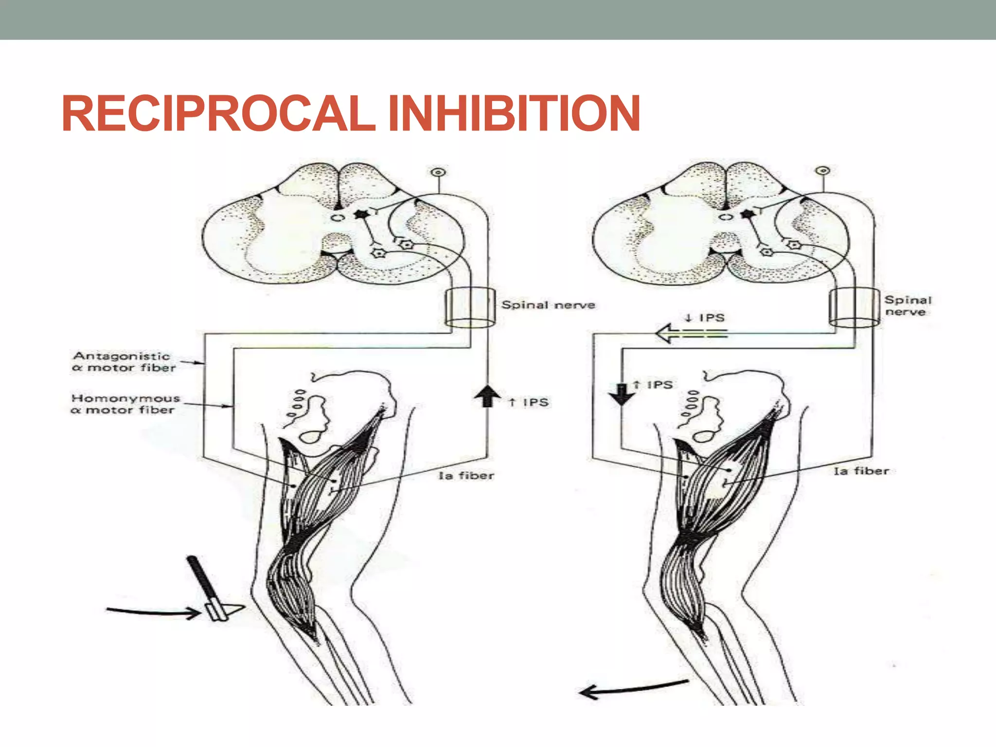 Pathophysiology of spasticity | PPTX