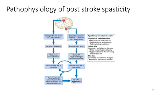 Pathophysiology of Spasticity | PPTX