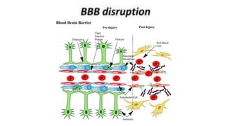 Traumatic Brain Injury (TBI) | PPTX