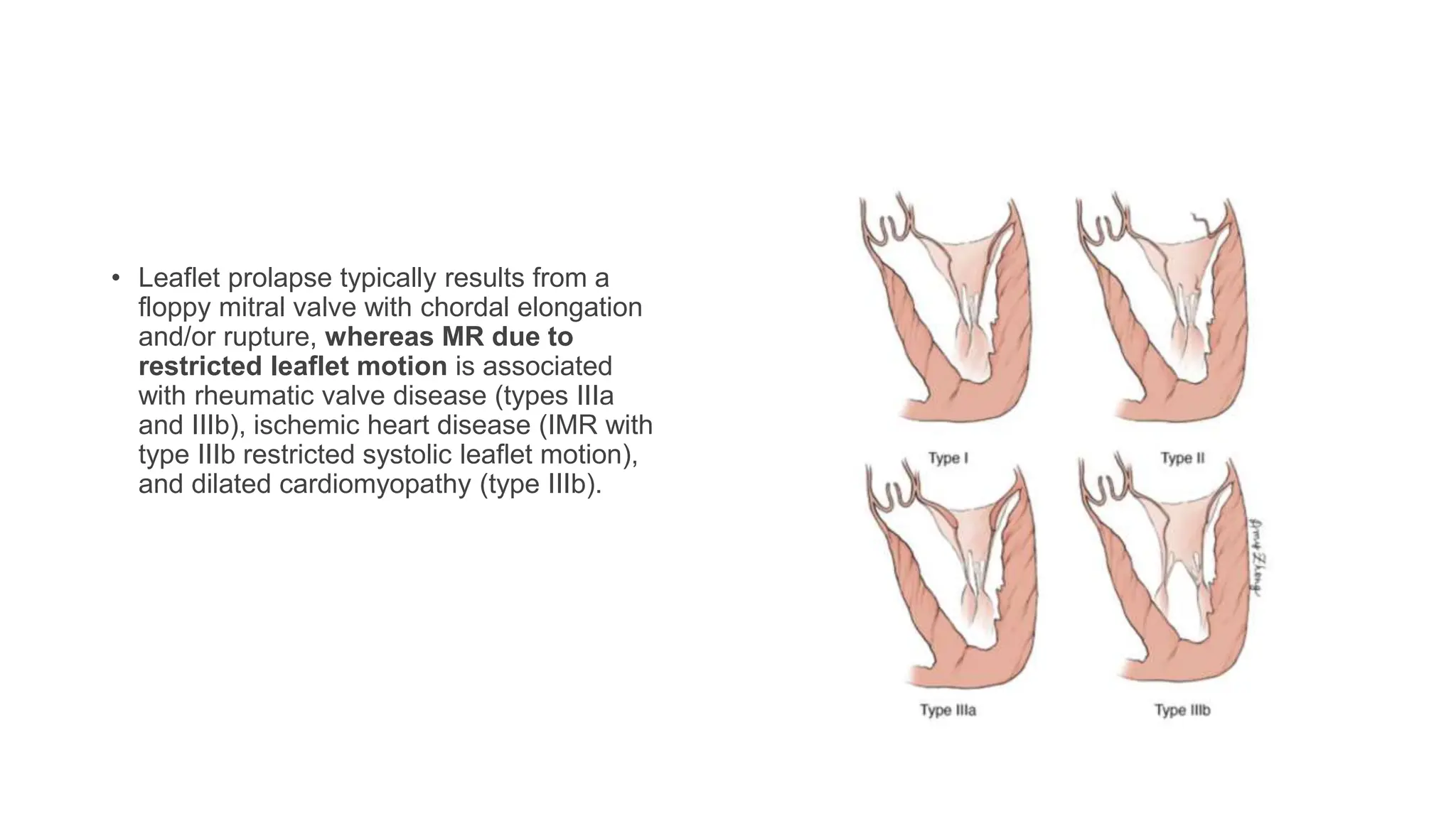 Pathophysiology of the Mitral Valve .pptx
