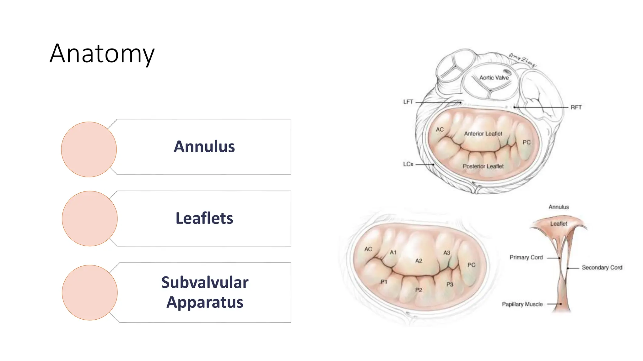 Pathophysiology of the Mitral Valve .pptx