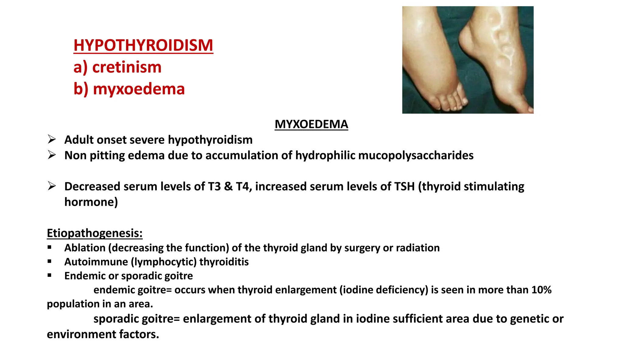 pathophysiology of thyroid disorders.pptx