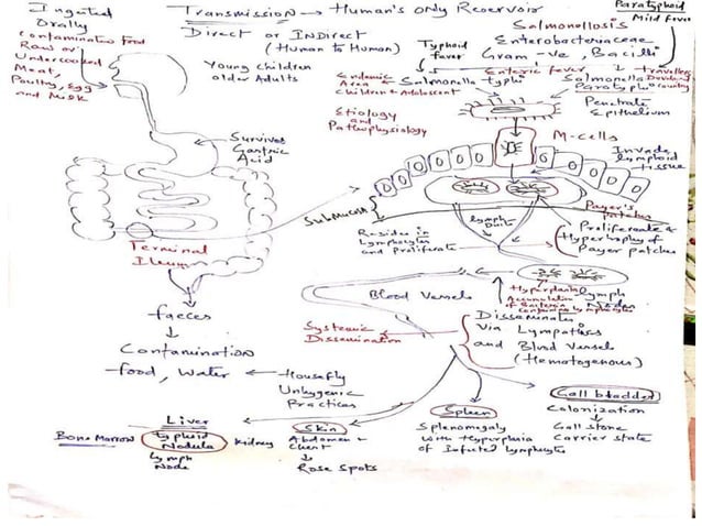 Pathophysiology of typhoid | PPTX