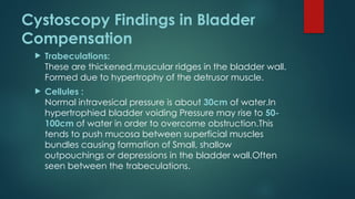 Pathophysiology of urinary tract obstruction.pptx