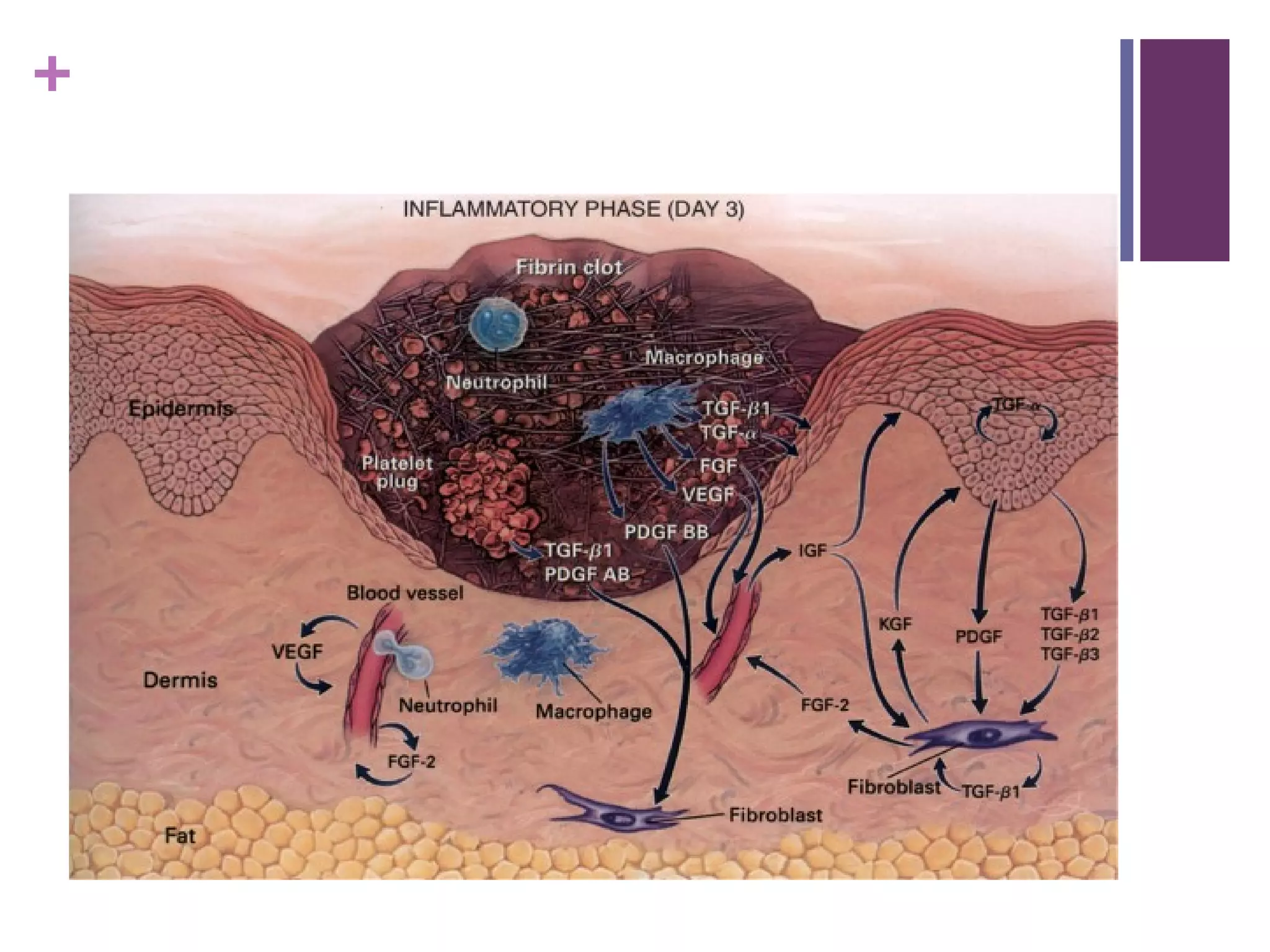 Pathophysiology of wound healing | PPT
