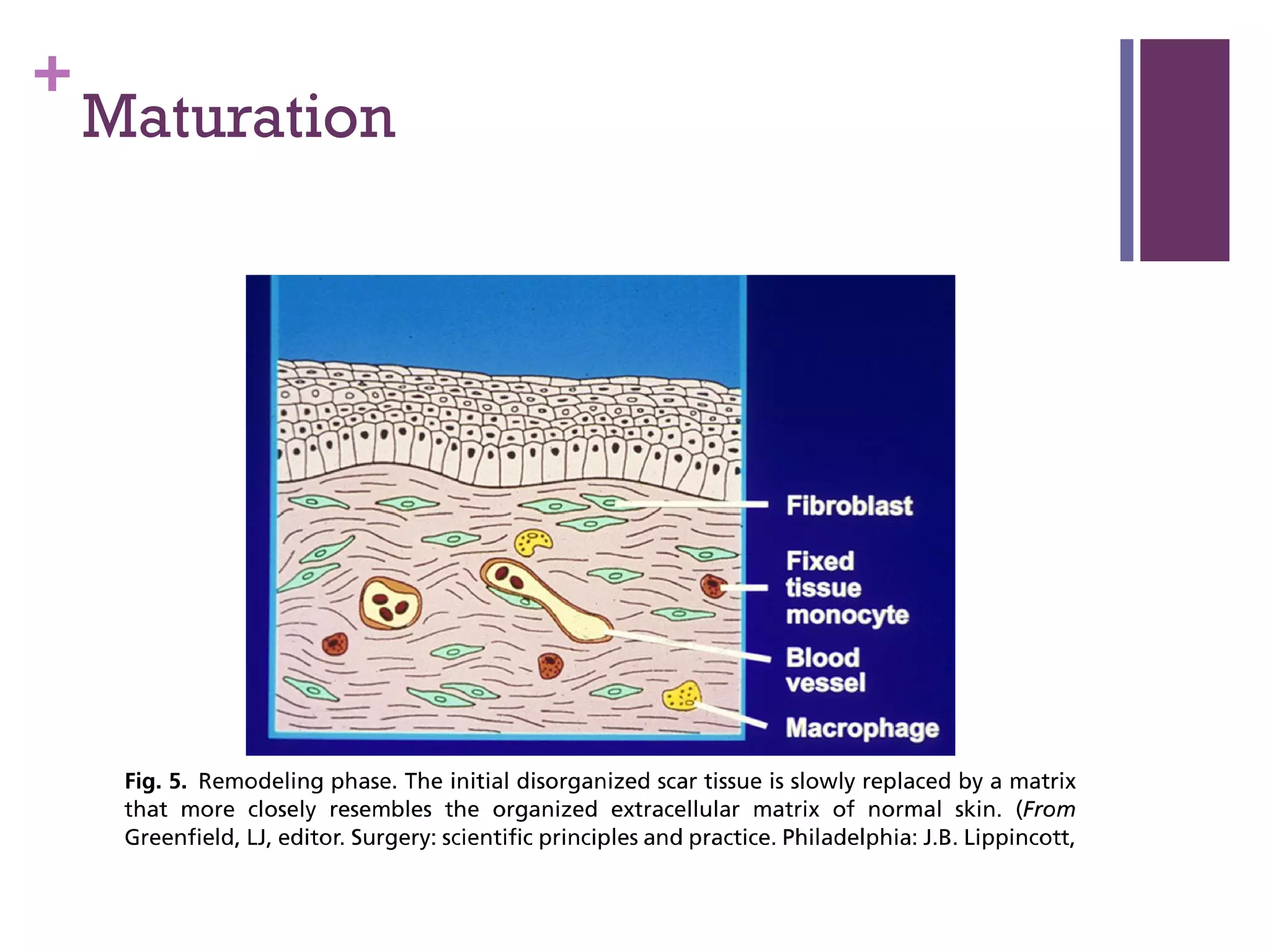 Pathophysiology of wound healing | PPT