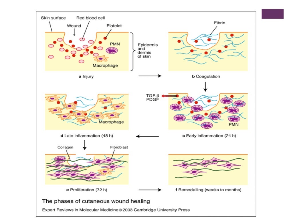Pathophysiology of wound healing