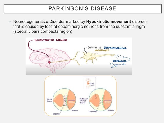 Pathophysiology of parkinsons disease