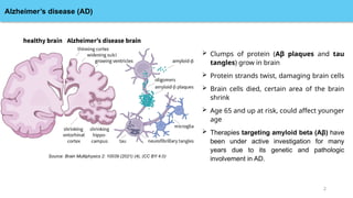 Pathophysiology presentation_ALzheimer disease.pptx