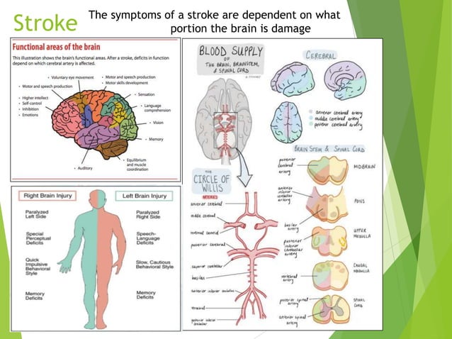 Pathophysiology stroke | PPTX | Brain and Nervous System Disorders ...