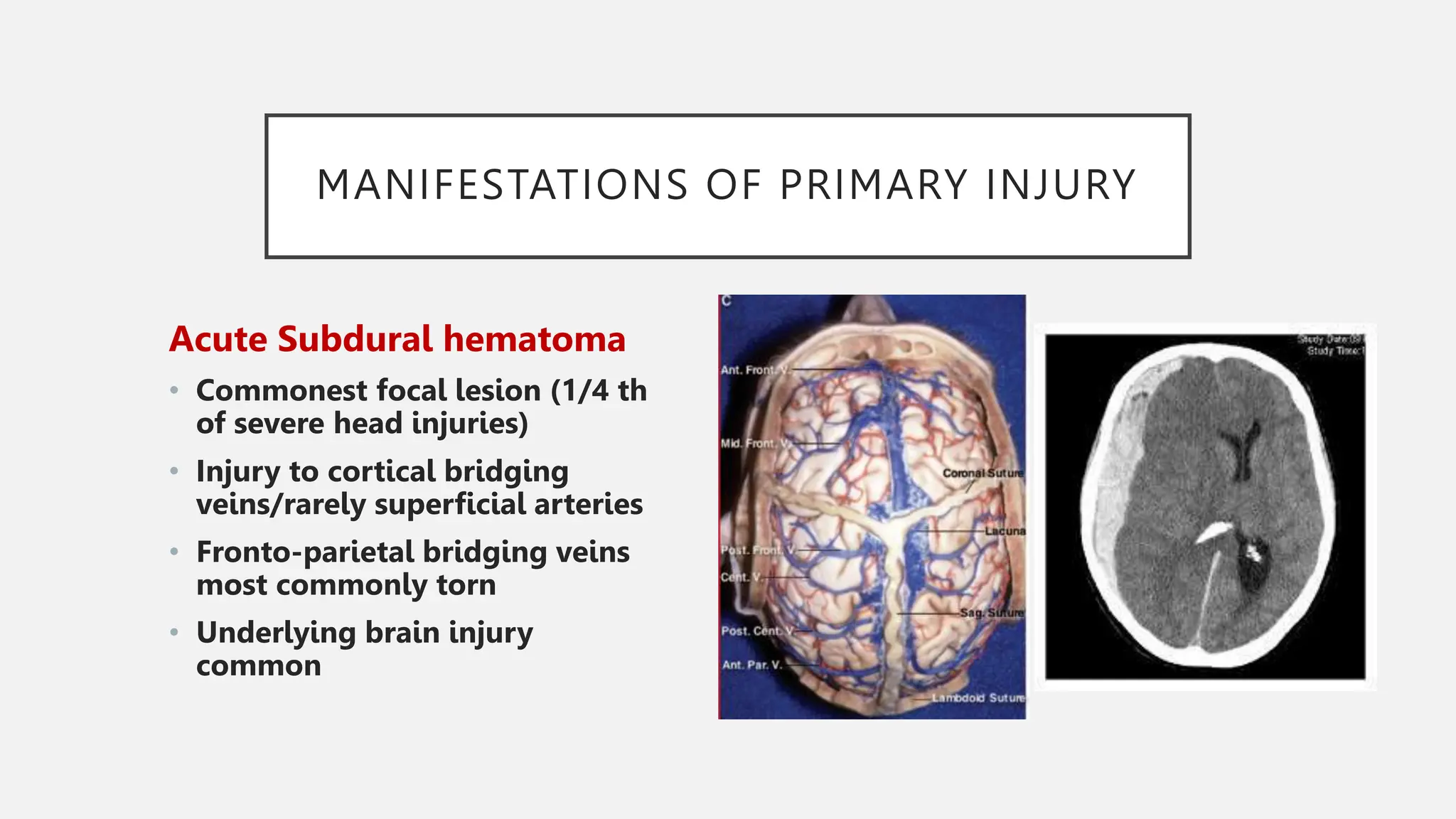 Pathophysiology of traumatic brain injury.pptx