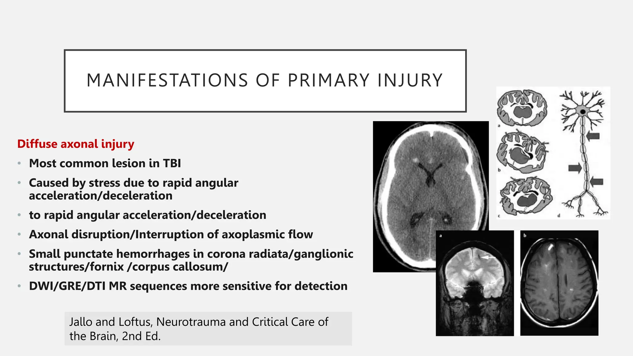 Pathophysiology of traumatic brain injury.pptx