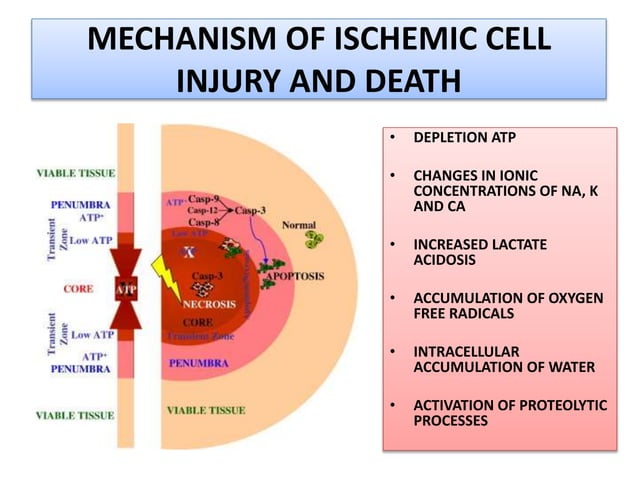 Pathophysioloy of stroke