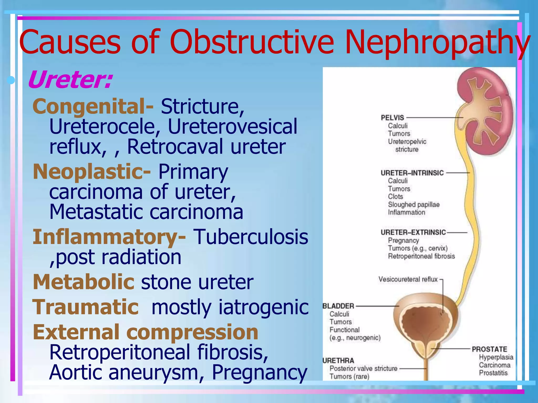 Pathophysioogy of urinary tract obstruction bassem presentation | PPT