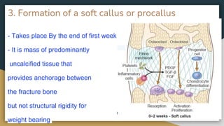 Fracture healing | PPT