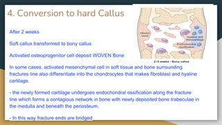 Fracture healing | PPT