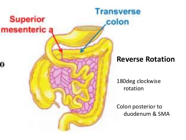 Pathopyshiology of Intestinal Obstruction CHIRANTAN MANDAL Medical Co…