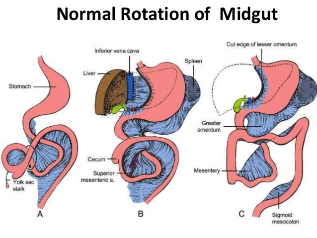 Pathopyshiology of Intestinal Obstruction CHIRANTAN MANDAL Medical Co…