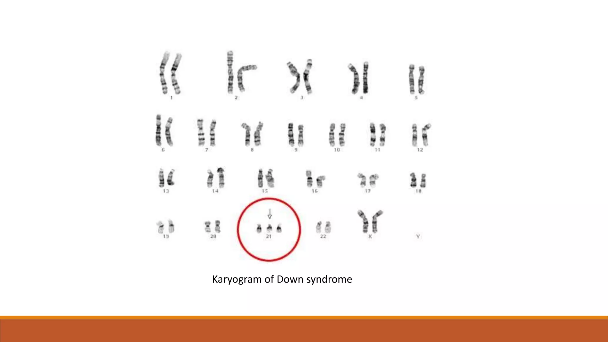 diagnosis of genetic defects.pptx