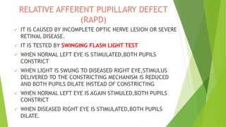 PATHWAY OF LIGHT REFLEX AND NEAR REFLEX.pptx