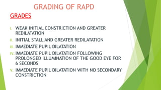 PATHWAY OF LIGHT REFLEX AND NEAR REFLEX.pptx | Death, Injury, or ...
