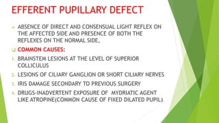 PATHWAY OF LIGHT REFLEX AND NEAR REFLEX.pptx