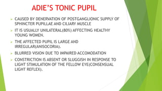 PATHWAY OF LIGHT REFLEX AND NEAR REFLEX.pptx