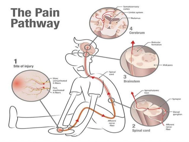 Pathway of Pain